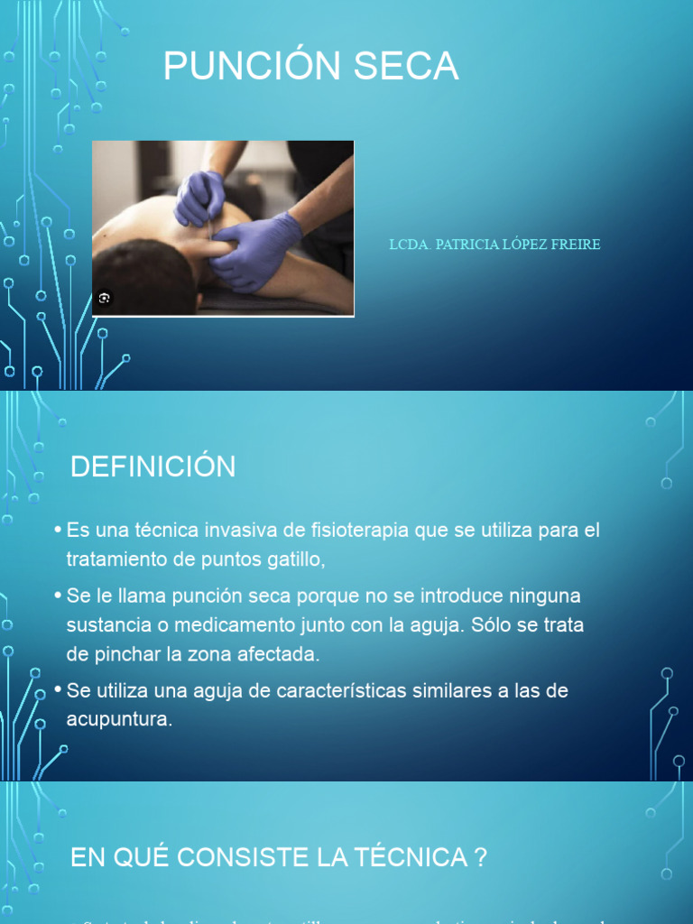 Punción Seca | PDF | Dolor | Punto gatillo miofascial