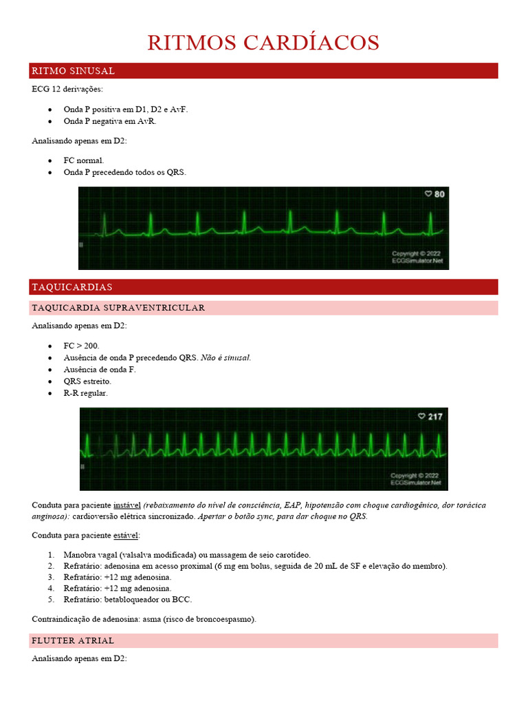 ACLS | PDF | Eletrocardiografia | Infarto do Miocárdio