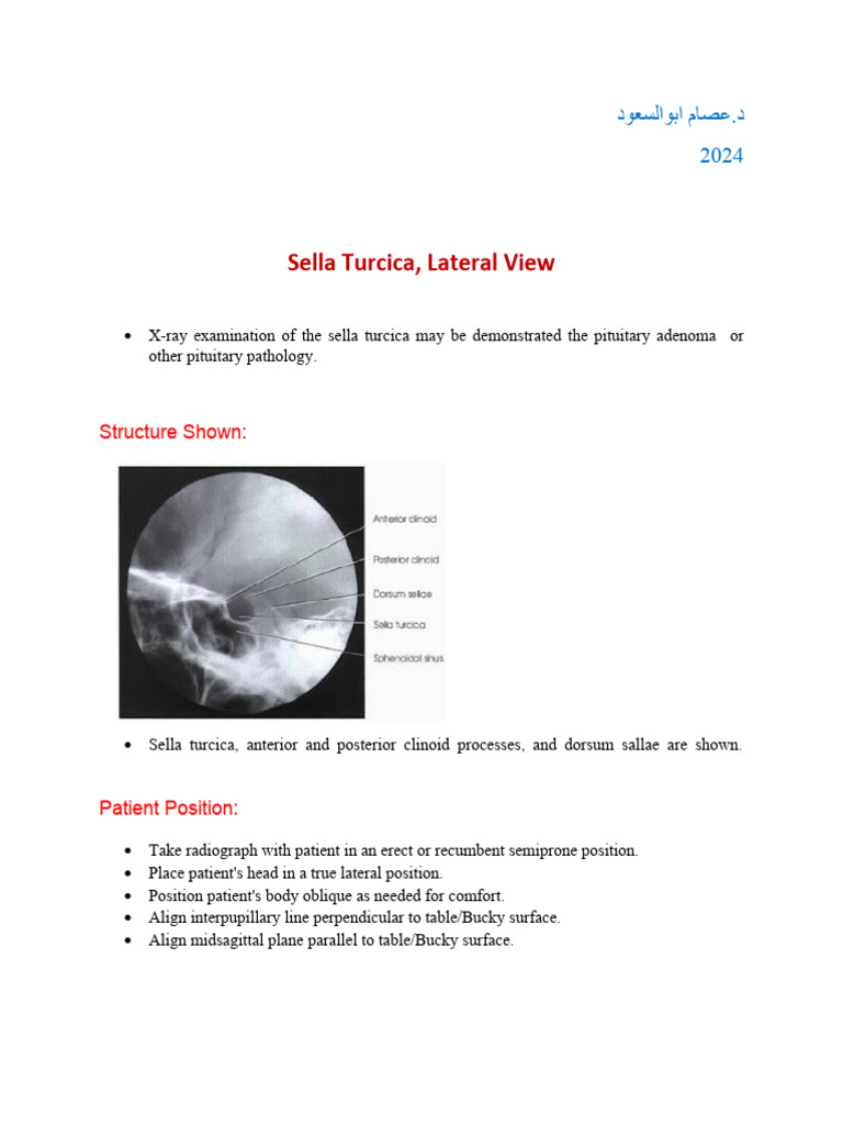 9 skull RT | PDF | Anatomical Terms Of Location | Radiography