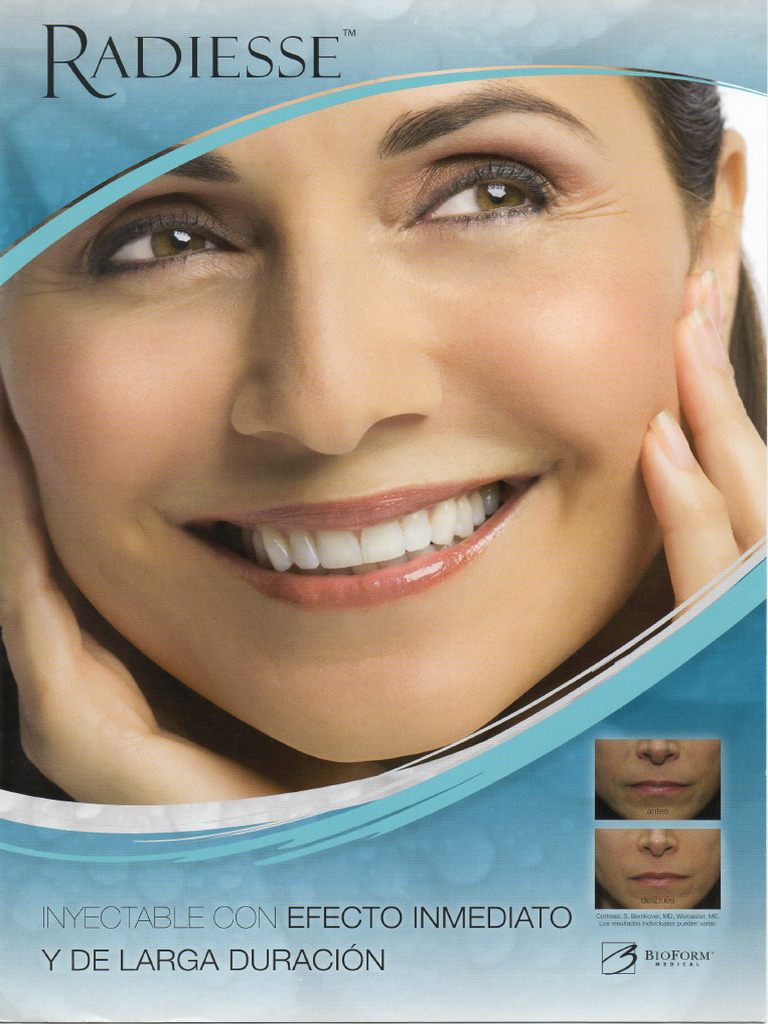 Brochure Radiesse | PDF