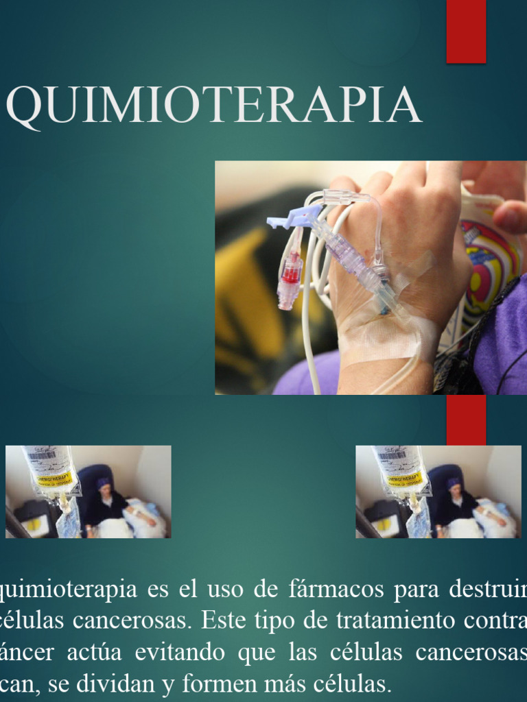 QUIMIOTERAPIA | PDF | Quimioterapia | Medicina CLINICA
