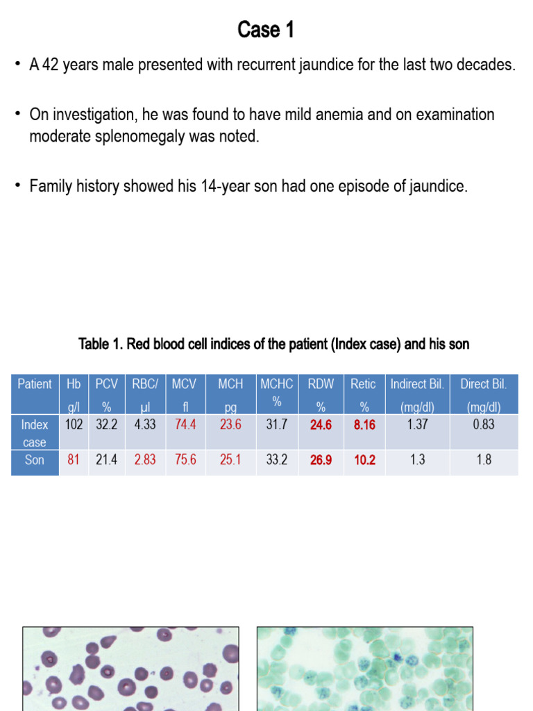 Hemolytic Anemia Case Studies Analysis | PDF | Anemia | Diseases And ...