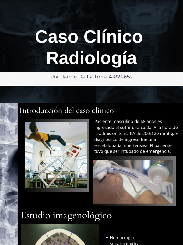 Caso Clinico Radiologia Jaime de La Torre | PDF | Medicina CLINICA | Especialidades Medicas