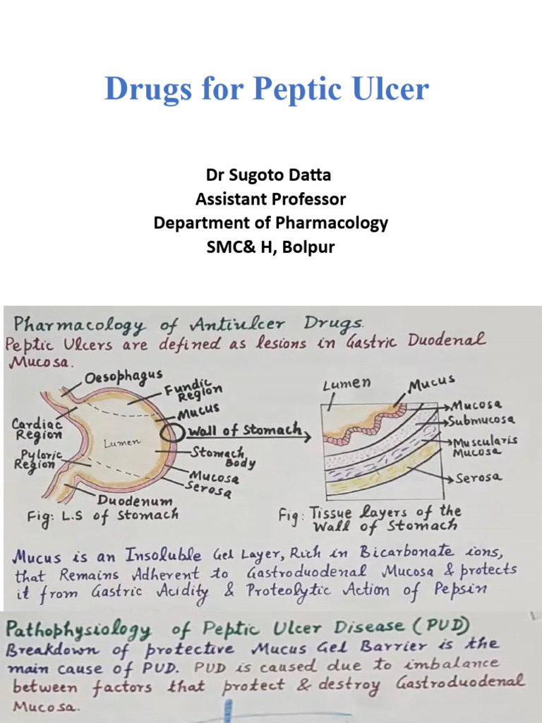 Peptic Ulcer | PDF | Science & Mathematics