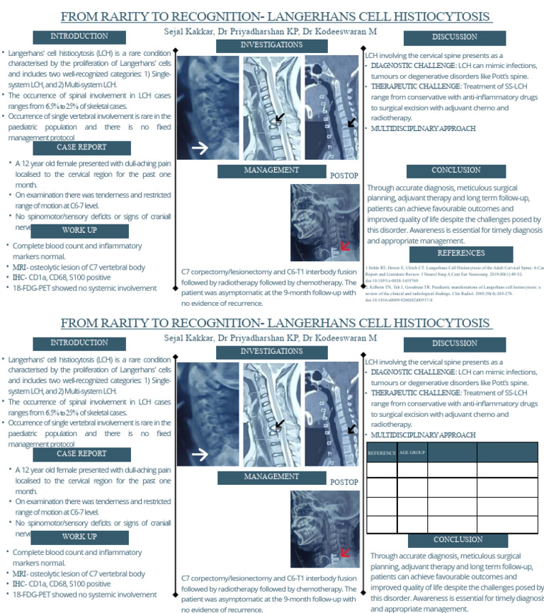 Pediatric Cervical Spine LCH Case | PDF | Radiation Therapy | Vertebral Column