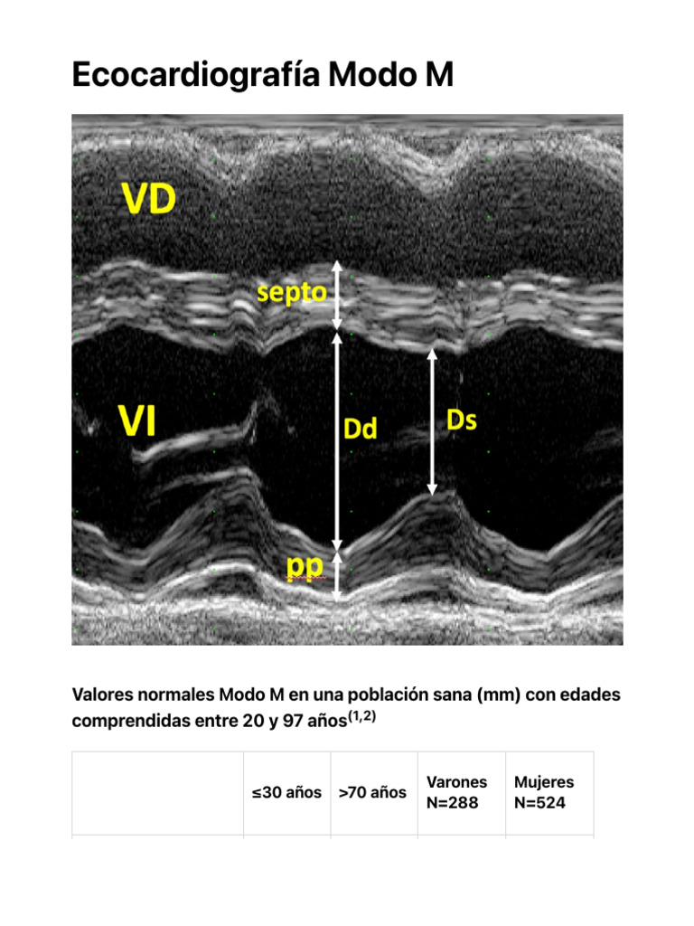 Ecocardiografía Modo M | PDF | Science & Mathematics