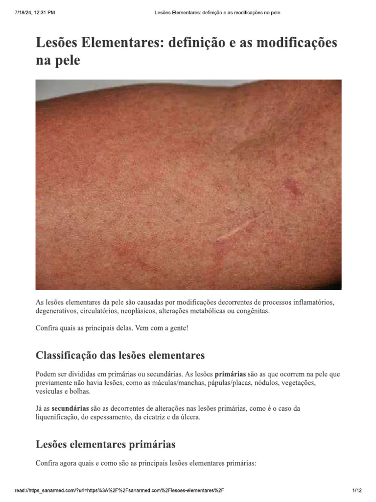 Lesões Elementares | PDF