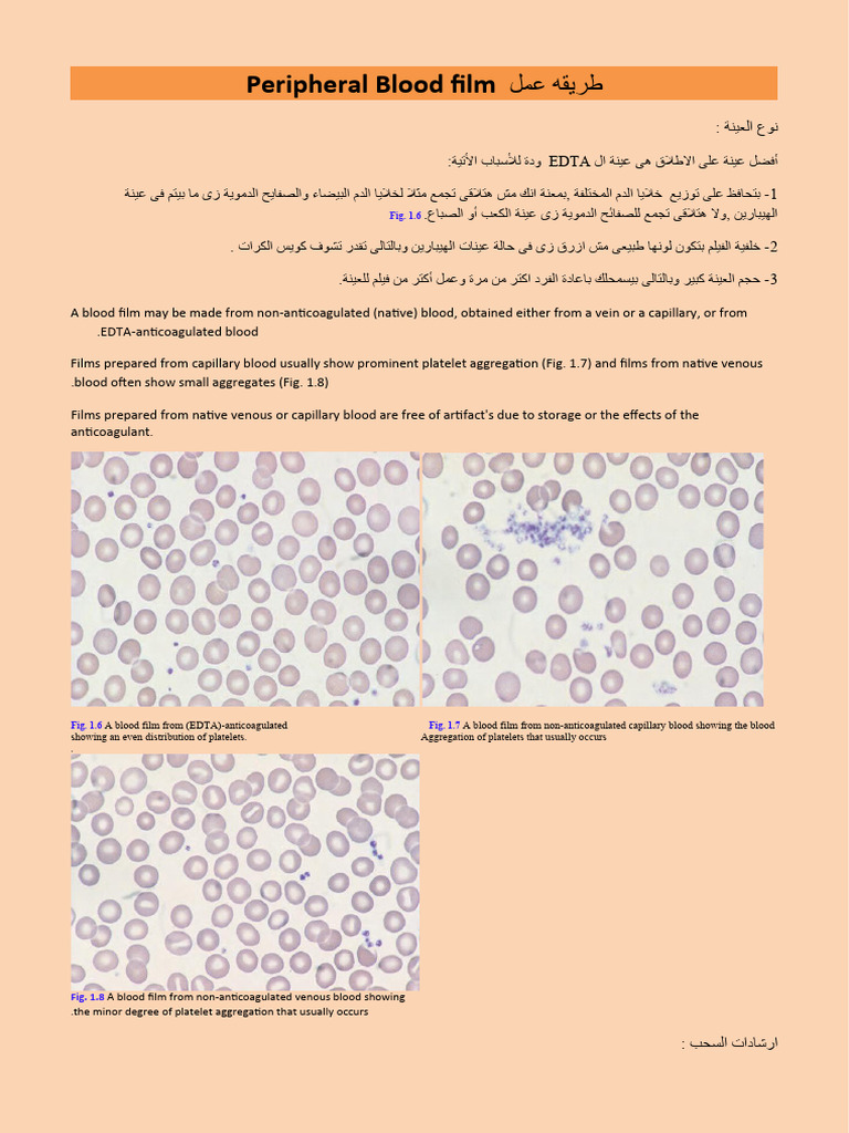 Blood Film | PDF
