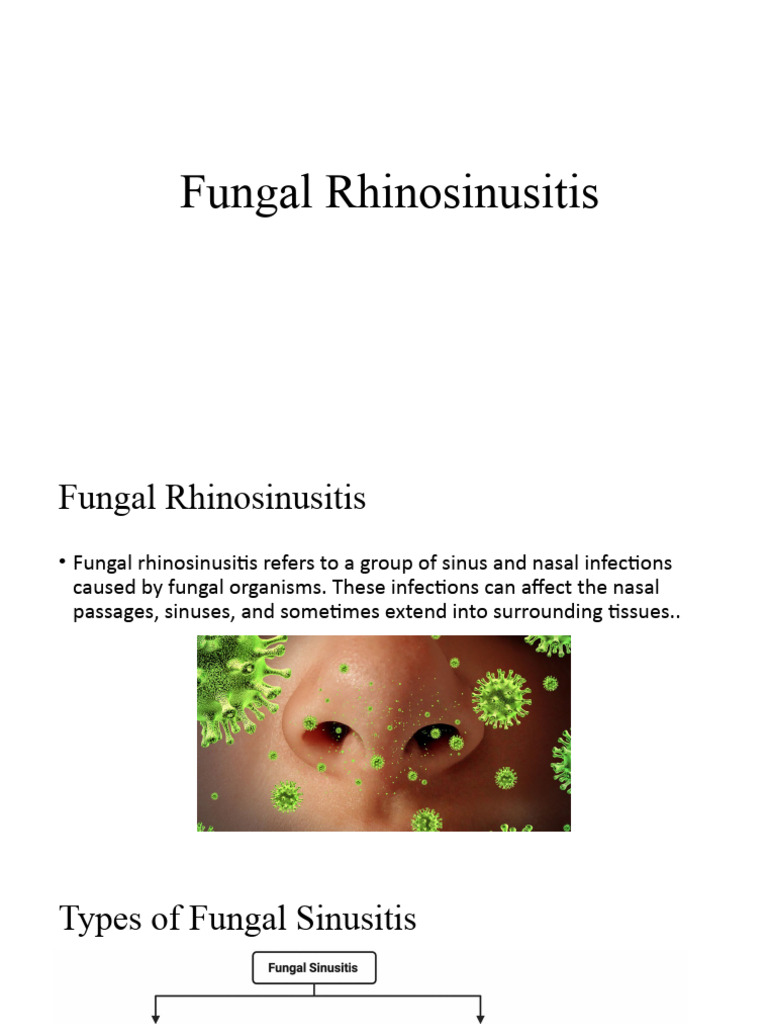 Allergic Fungal Rhinosinusitis | PDF | Allergy | Medical Specialties