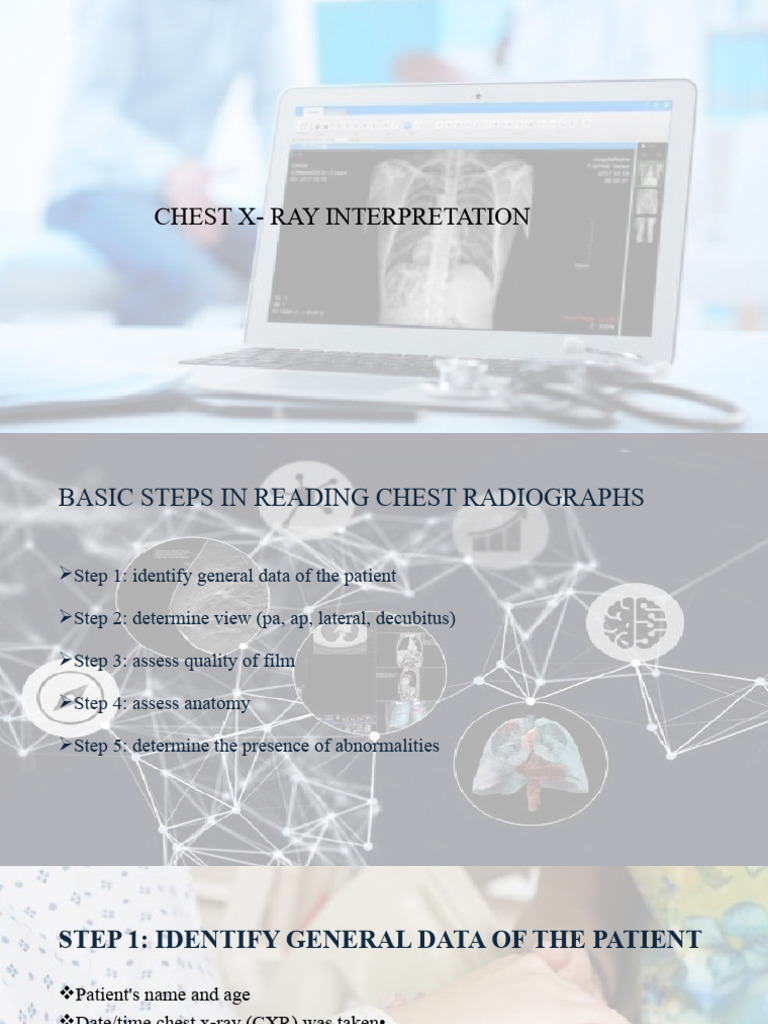 Chest X-Ray Final Draft | PDF | Anatomy | Thorax (Human Anatomy)