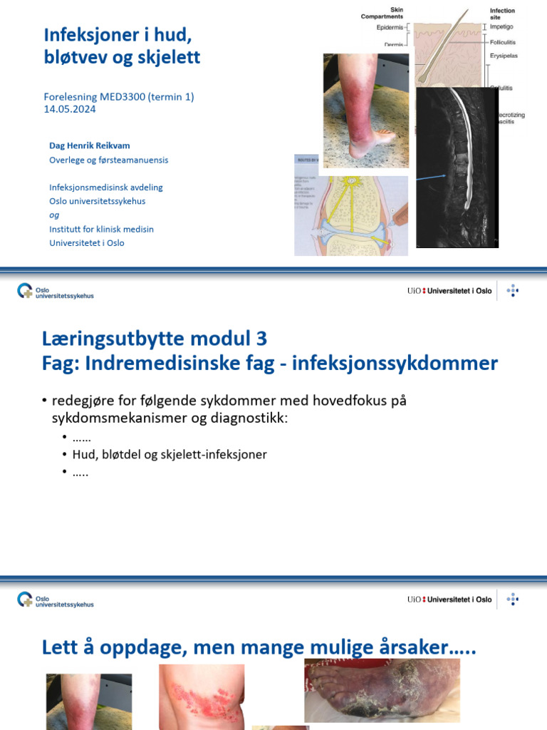 Infeksjoner I Hud Bloetvev Og Skjelett m3 v2024 | PDF