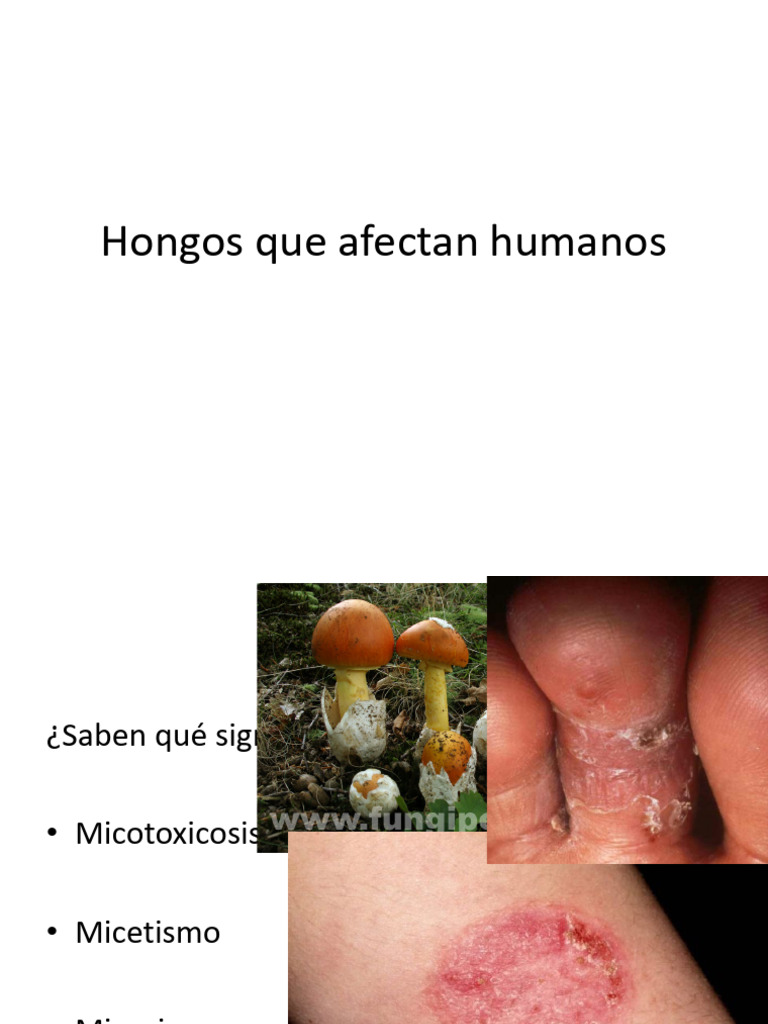 13 - Hongos Que Afectan Humanos | PDF | Microbiología | Micología
