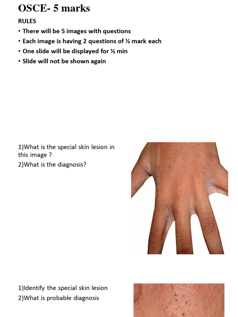 Osce (2) - 120422 | PDF