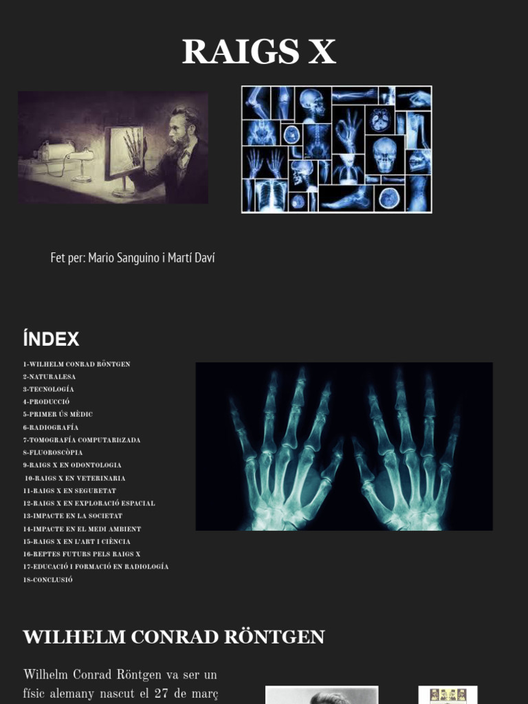 Raigs X | PDF