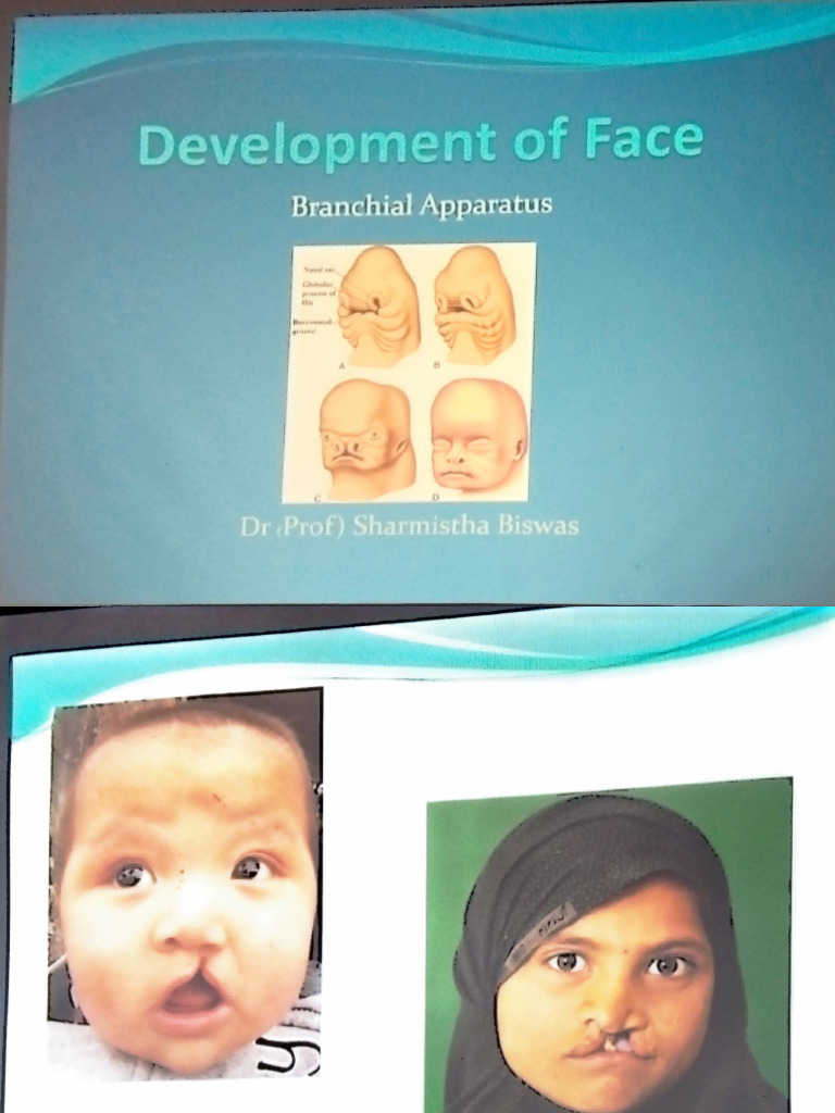 Pituitary Gland Development in Embryology | PDF | Morphology (Biology ...