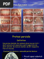 Chrome Cobalt RPD Design Overview | PDF | Dental Anatomy | Dentistry