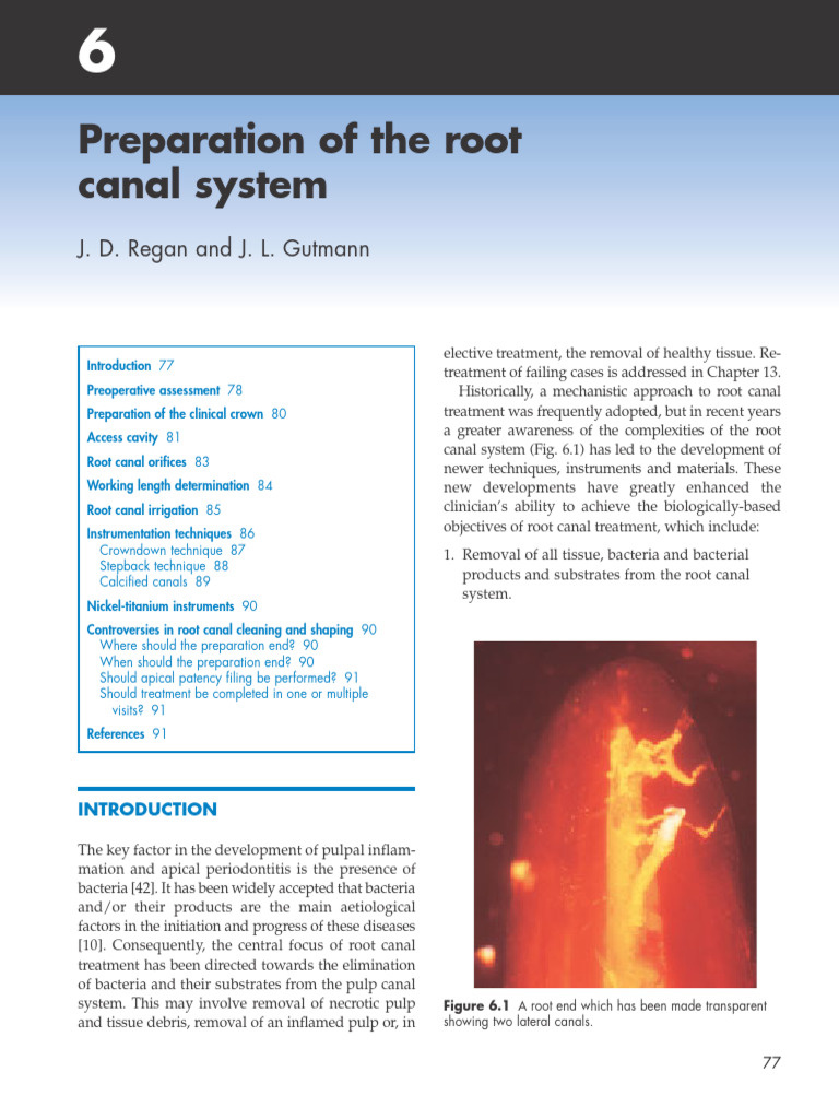 Preparation of The Root Canal System: J. D. Regan and J. L. Gutmann ...