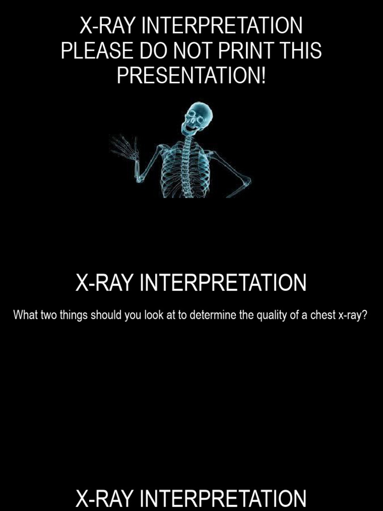 X-Ray Interpretation | PDF | Thorax | Lung