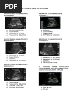 Anatomía del triángulo de Calot y Buddé | PDF | Vesícula biliar | Hígado