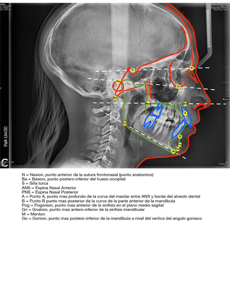 Lateral de Craneo 2 | PDF