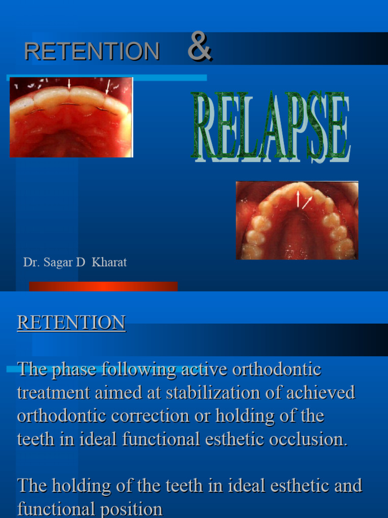 Retention and Relapse Ii | PDF | Orthodontics | Human Tooth
