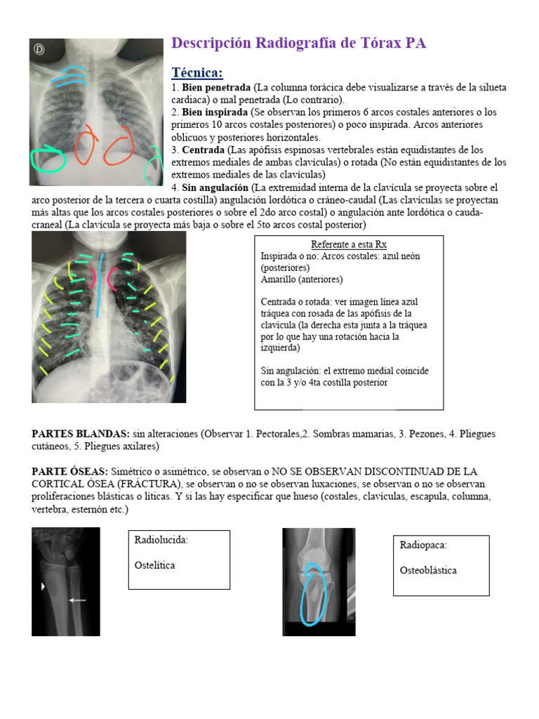 Descripción Radiografía de Tórax PA | PDF | Tórax | Pulmón