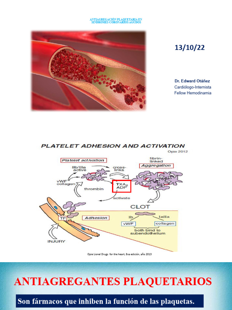 Antiagregación Plaquetaria en SCA | PDF | Salud y bienestar | Ciencia y matemáticas