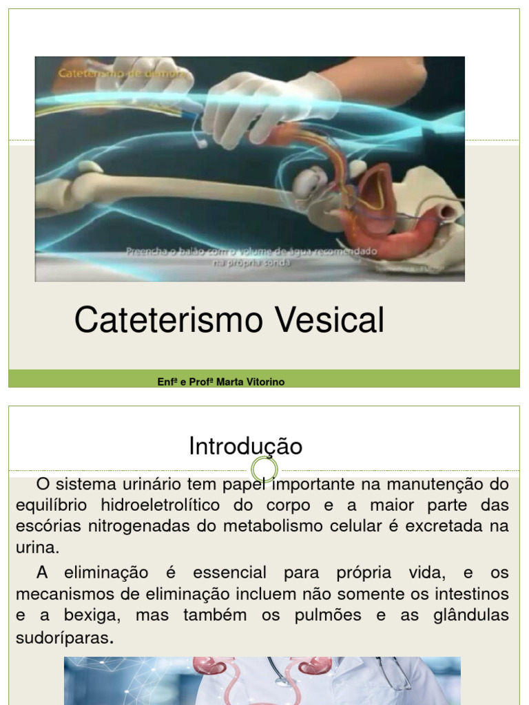 Cateterismo Vesical 2024 | PDF | Rim | Micção
