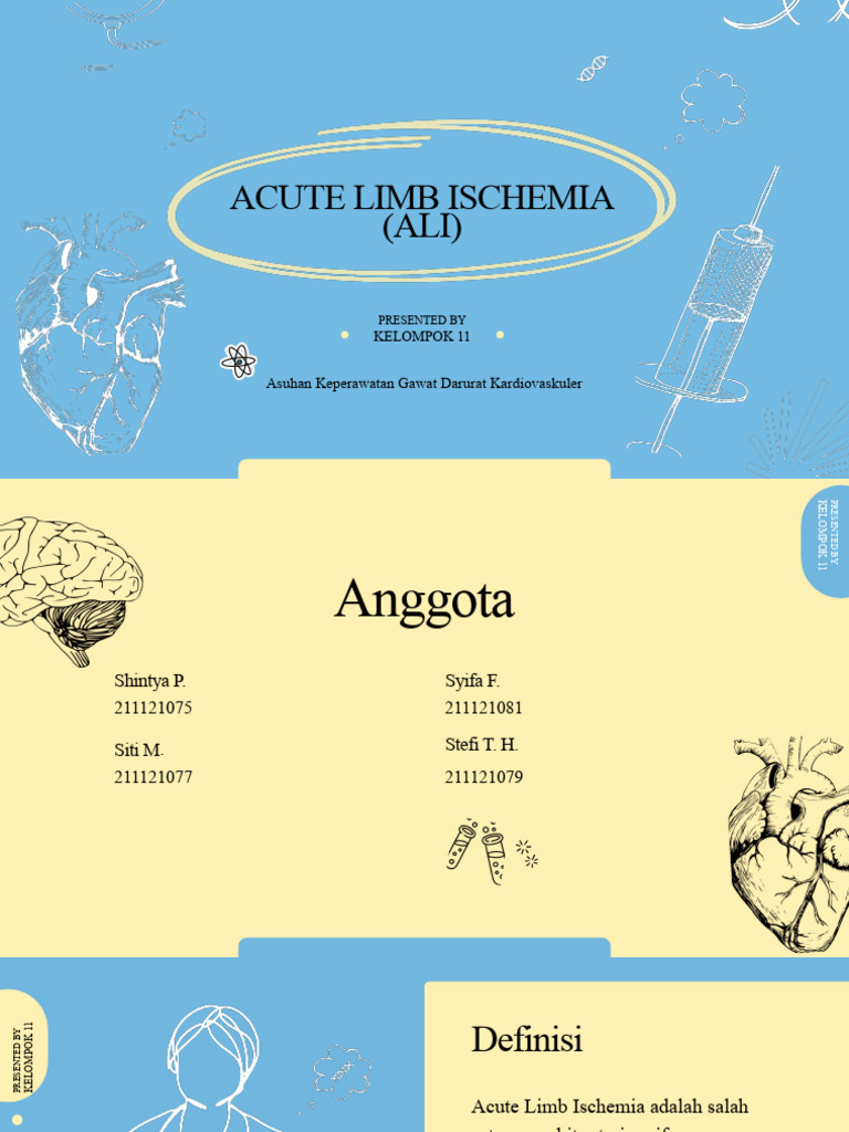 Acute Limb Ischemia | PDF