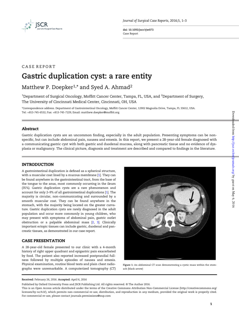 Gastric Duplication Cyst A Rare Entity | PDF | Pancreatic Cancer | Stomach