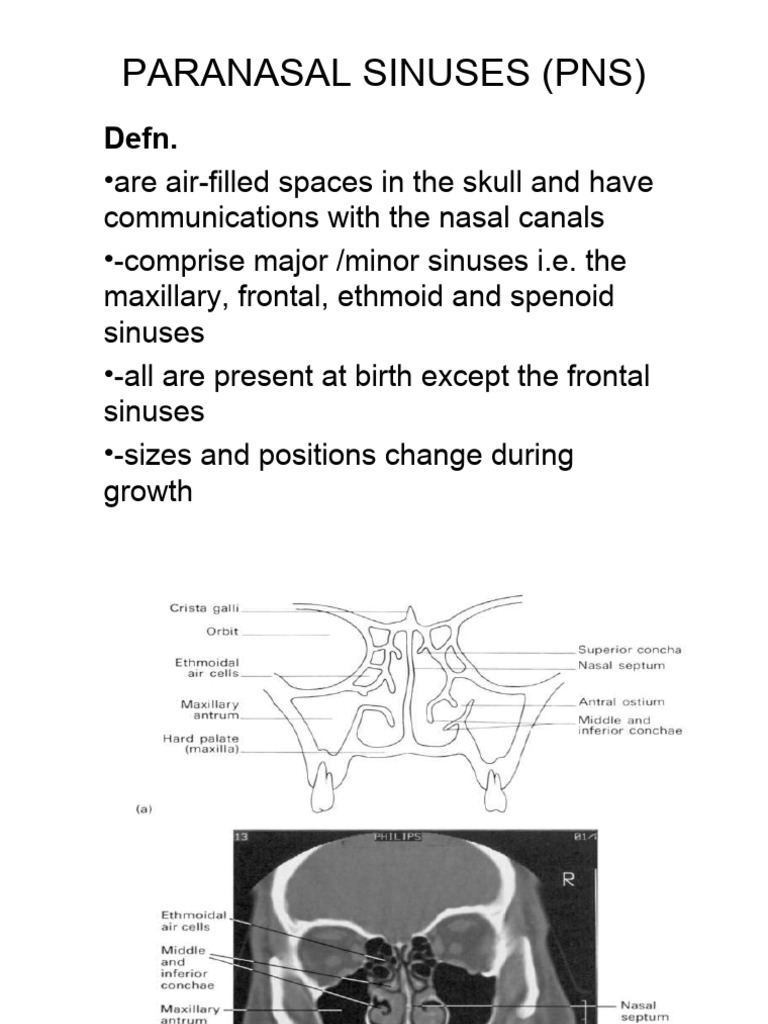 PARANASAL SINUSES (PNS) (Autosaved) | PDF | Human Nose | Human Head And ...
