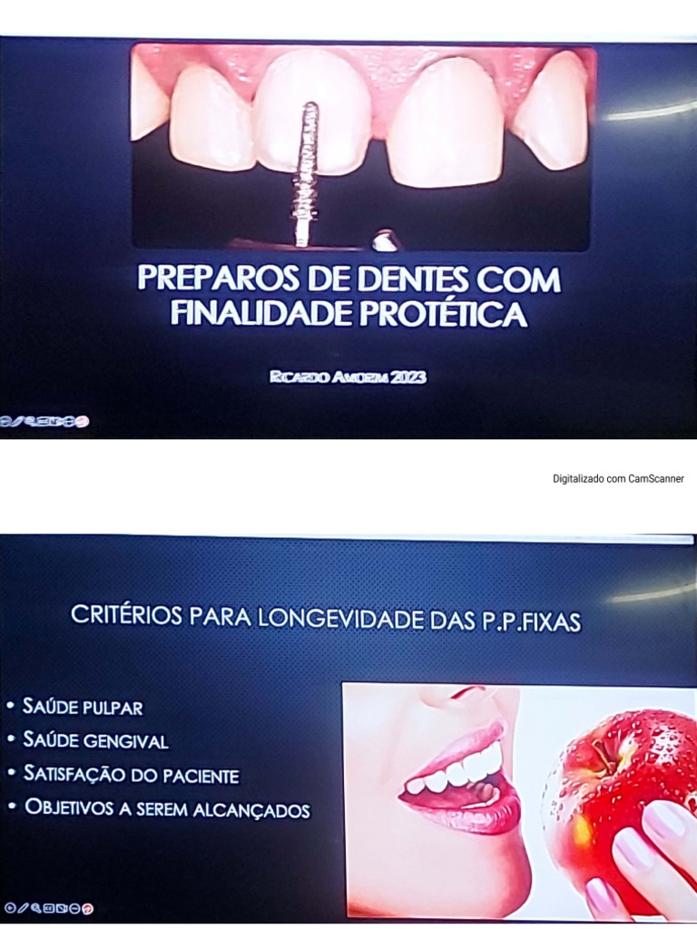 Aula Prótese 3 - Preparo Protético | PDF