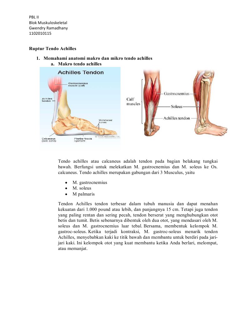 Ruptur Tendo Achilles | PDF