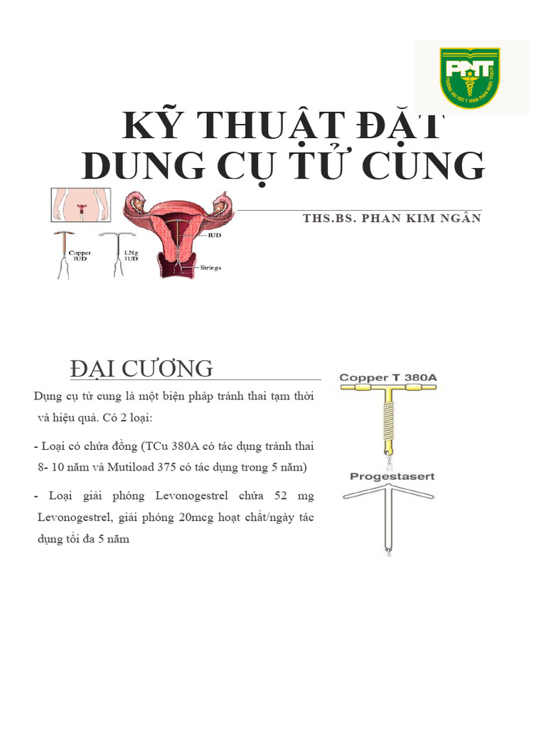 Open IUD 2 | PDF