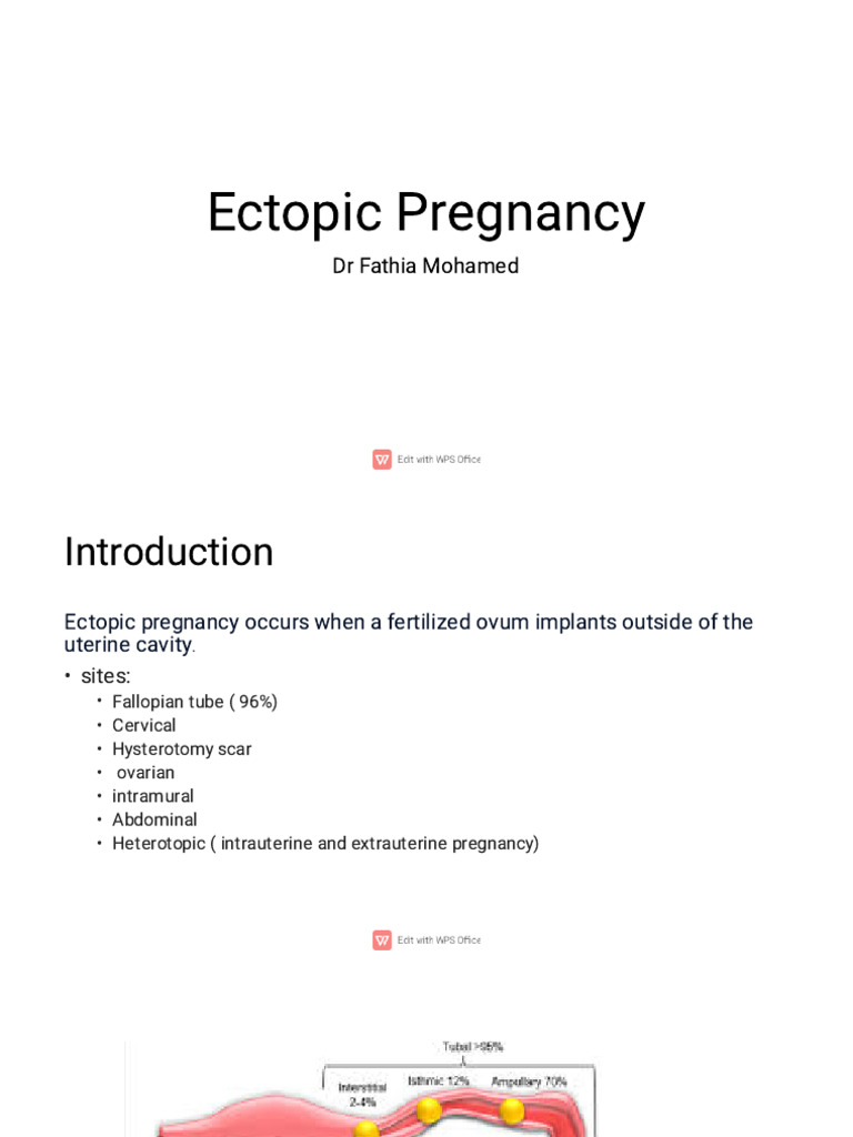 Ectopic Pregnancy | PDF | Uterus | Clinical Medicine