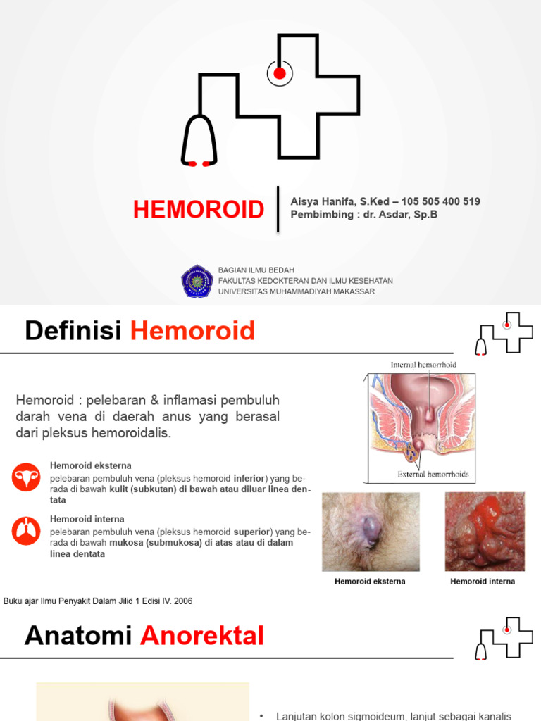 (Lapsus - Aisya Hanifa) Hemoroid | PDF