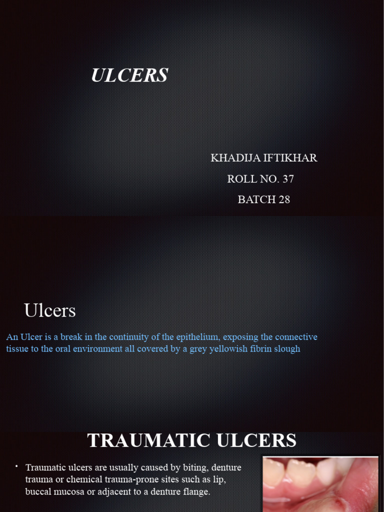 Ulcers Presentation | PDF | Medical Specialties | Diseases And Disorders
