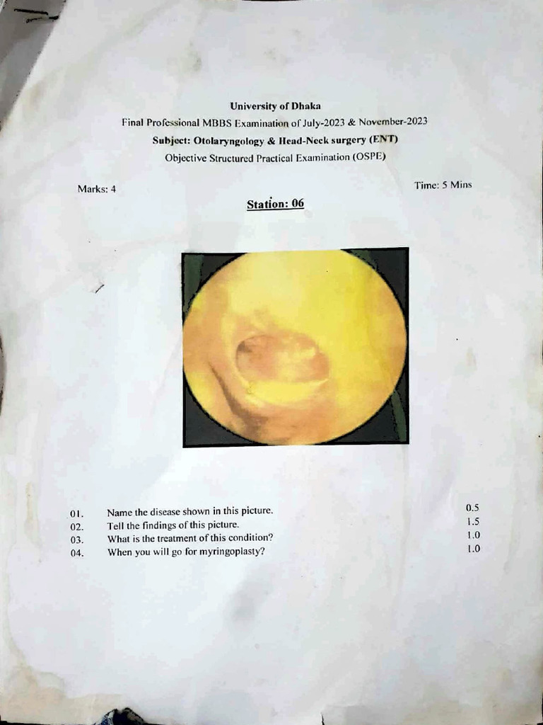 Ent Ospe Solve by Nizhum | PDF