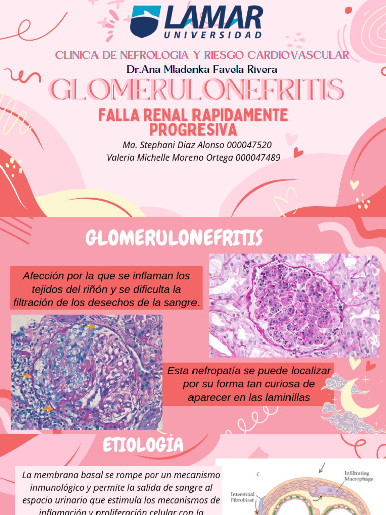 Presentación Glomerulonefritis Rapidamente Progresiva | PDF | Especialidades Medicas | Medicina ...