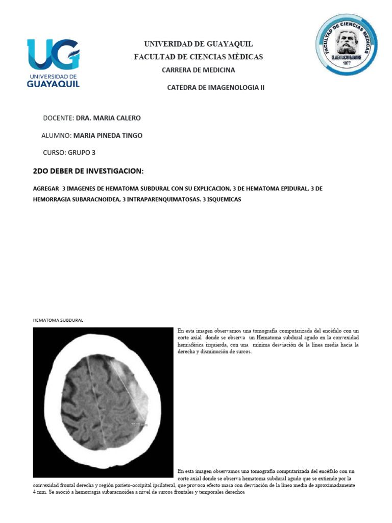 2do Deber de Imagenologia | PDF | Cerebro | Neurociencia