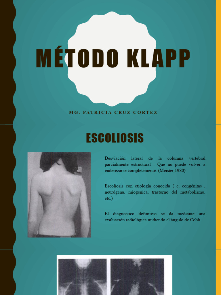 Método Klapp | PDF | Escoliosis | La columna vertebral