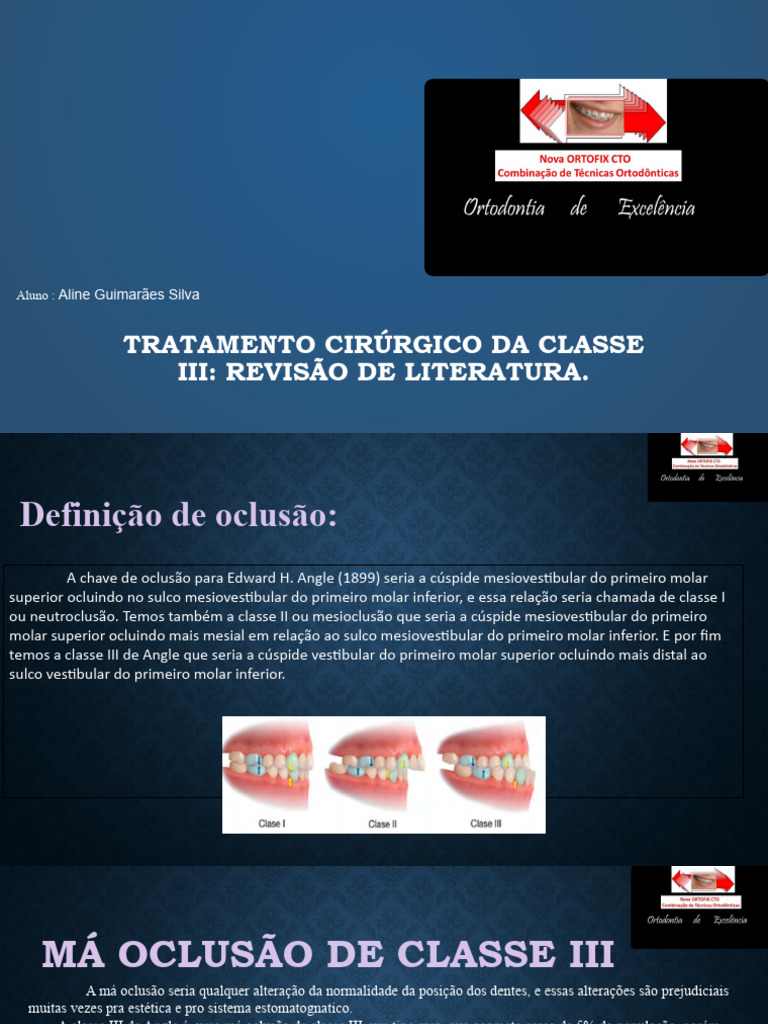 Apresentação Classe III - Aline-2 | PDF | Ortodontia | Áreas da odontologia
