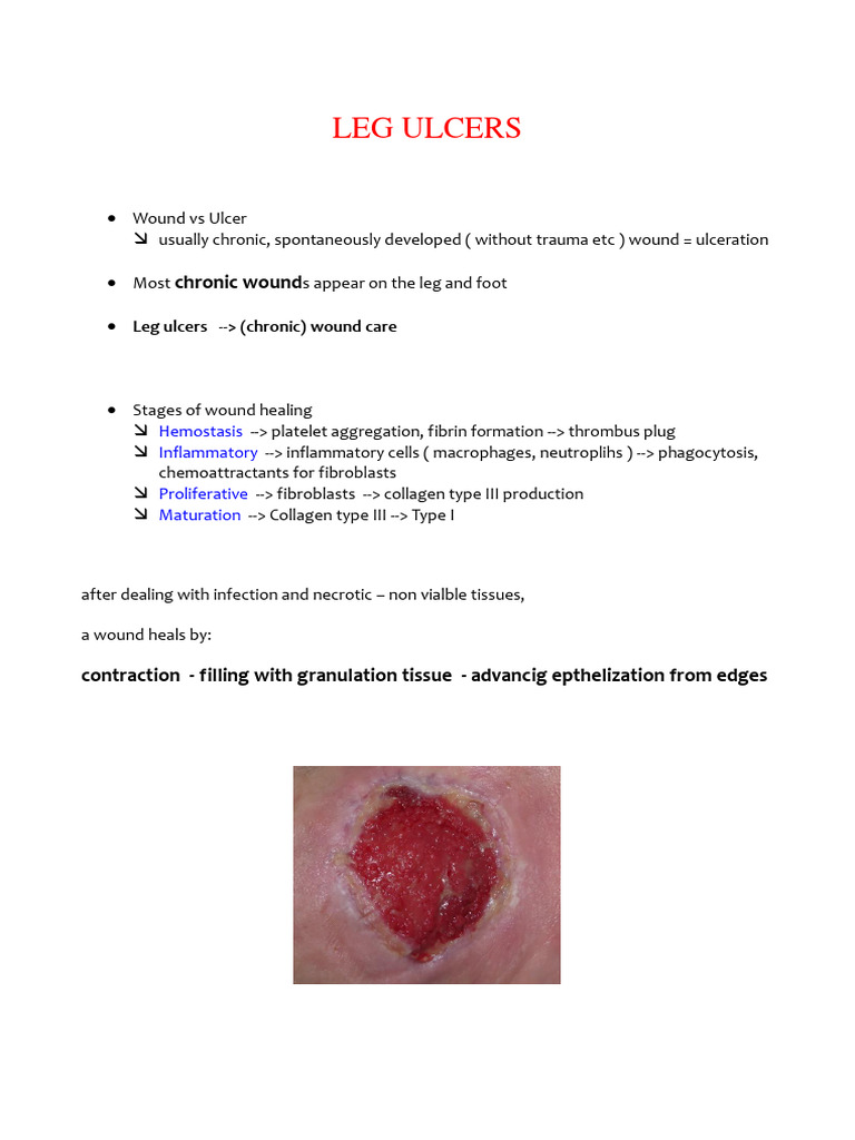 Leg Ulcers | PDF | Healing | Wound