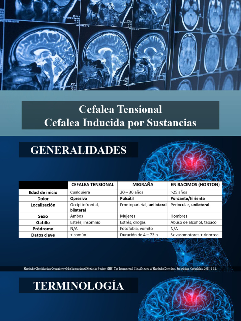 Cefalea Tensional y Cefalea Inducida Por Sustancias | PDF | Headache | Clinical Medicine