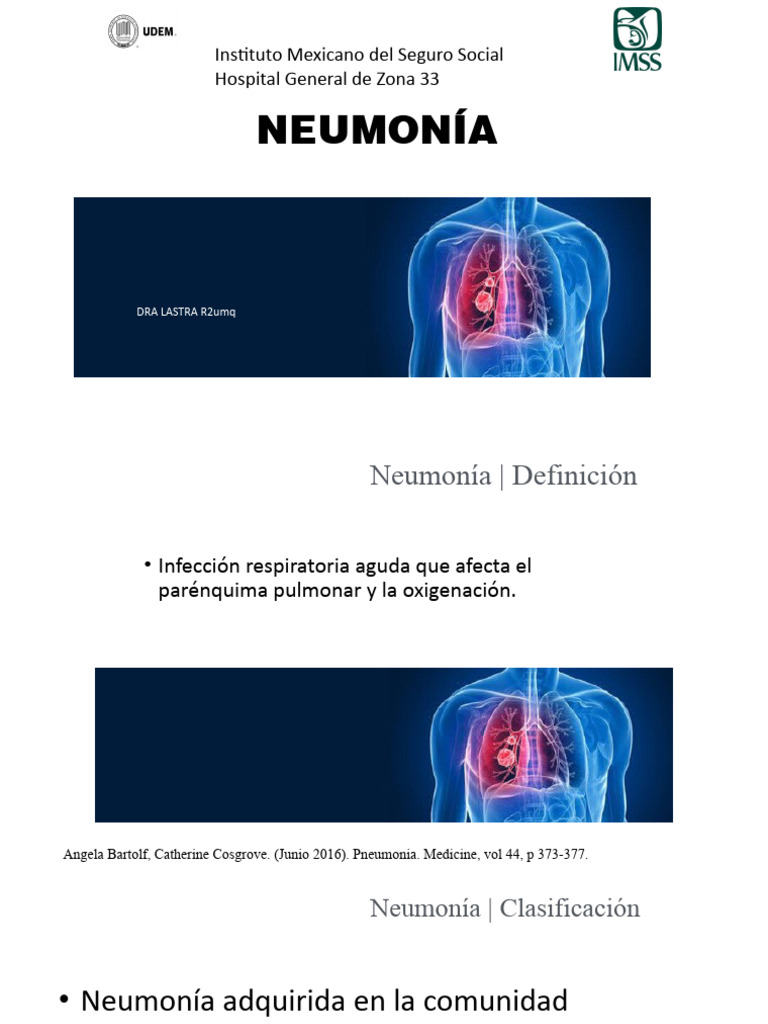 Guía Completa sobre Neumonía | PDF | Neumonía | Enfermedades respiratorias