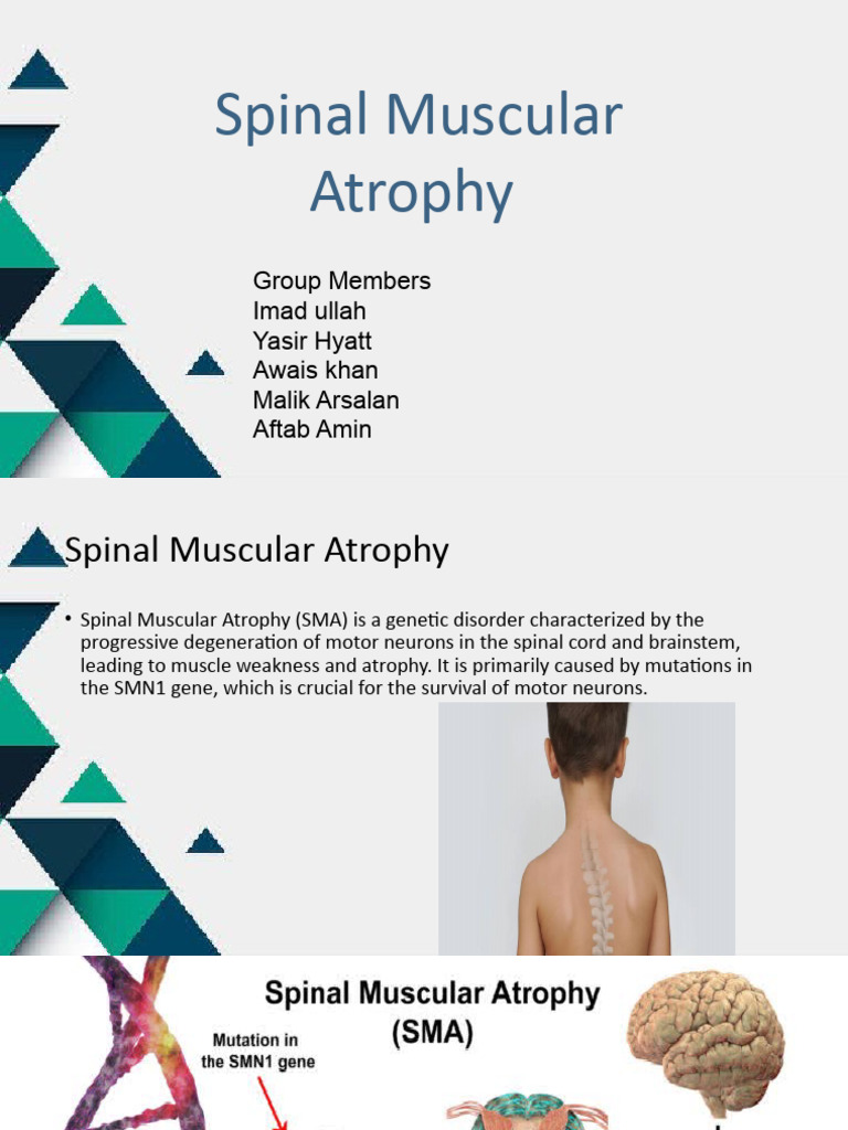 Spinal Muscular Atrophy | PDF | Human Diseases And Disorders | Medical ...