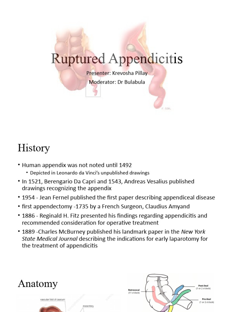 Appendicitis | PDF | Sepsis | Medical Specialties