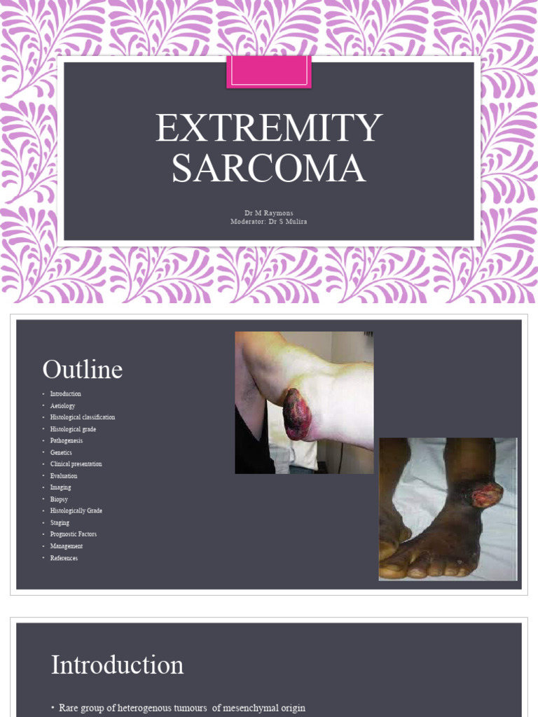 Extremity Sarcoma | PDF | Sarcoma | Biopsy