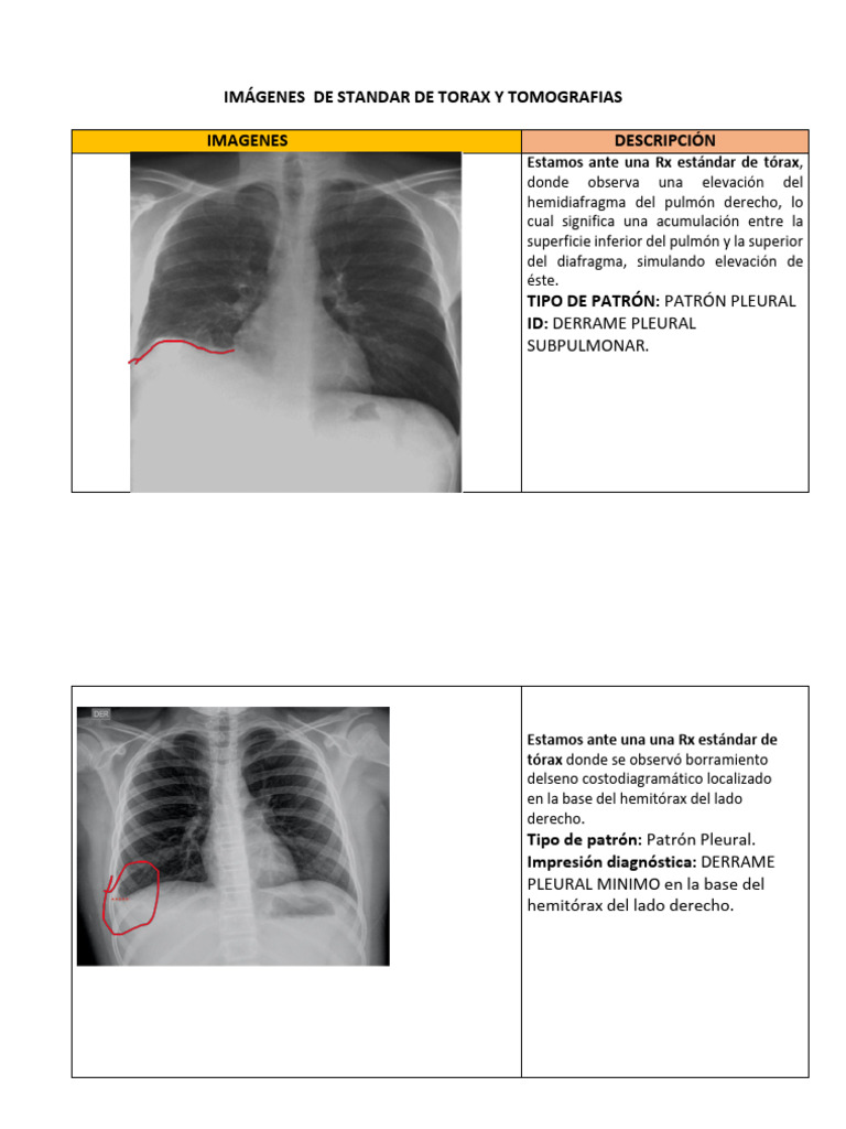 RX y TC de Patron Pelural, Cardiovascular, Etc Todas Las Imagenes | PDF ...