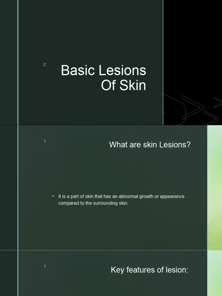Basic Lesions of Skin | PDF | Skin | Dermatology